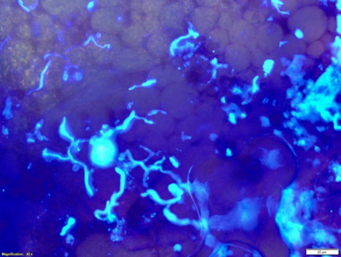 Microscopic World: First CU-Lock Haven biological sciences graduate ...